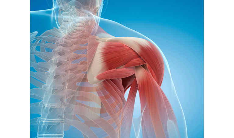 How Long Does it Take to Recover from a Shoulder Muscle Tear? - Buy CBD ...